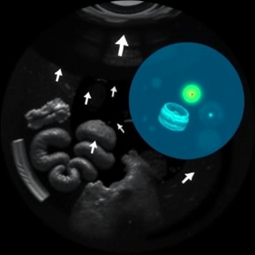 Using Roundness to Predict Bowel Necrosis in Intussusception – BioTechGrid